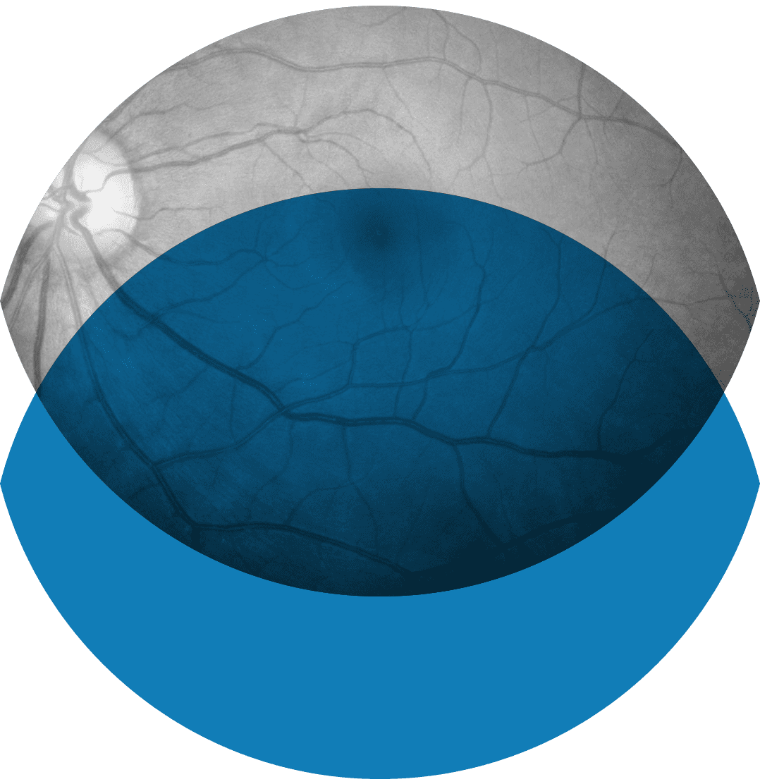 Medische retina - Oculux Oogcentrum